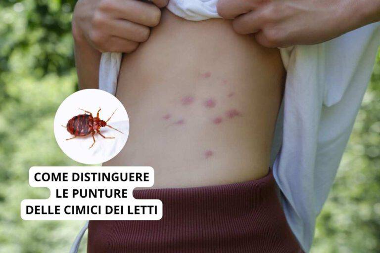 Punture delle cimici dei letti: come distinguerle